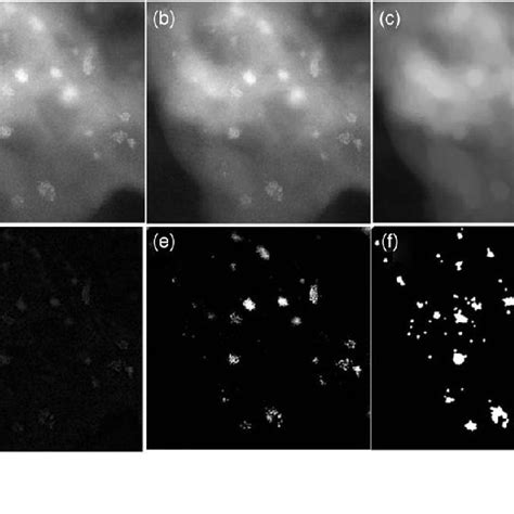 Determination Of A Disk Size For The Morphological Closing Operation