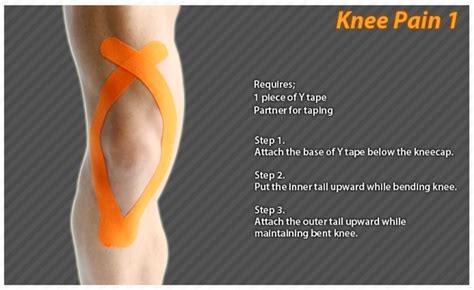 Kt Tape Knee Bursitis Hubshery
