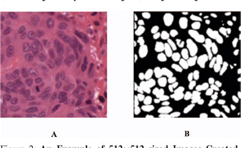 Figure 2 From Nuclei Segmentation In Hematoxylin And Eosin Hande Stained Histopathological