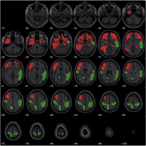 Two Dimensional Anisotropic Gaussian Filters Can Be Decomposed Into The Download Scientific