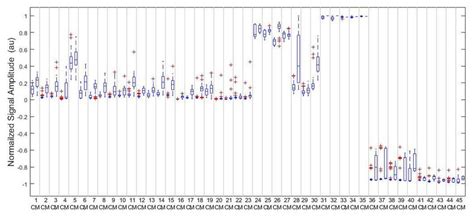 Normalized Amplitude Variation Of Clean C And Mna M Ppg Signals Of