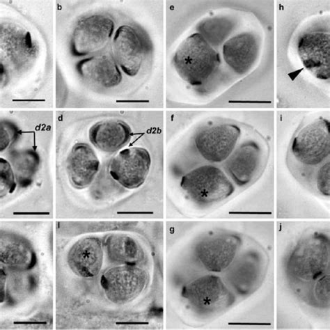 First Meiotic Division In Pollen Mother Cells Of Barley A Pachytenc
