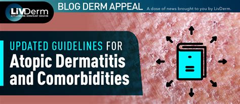 Updated Guidelines For Atopic Dermatitis And Comorbidities Livderm