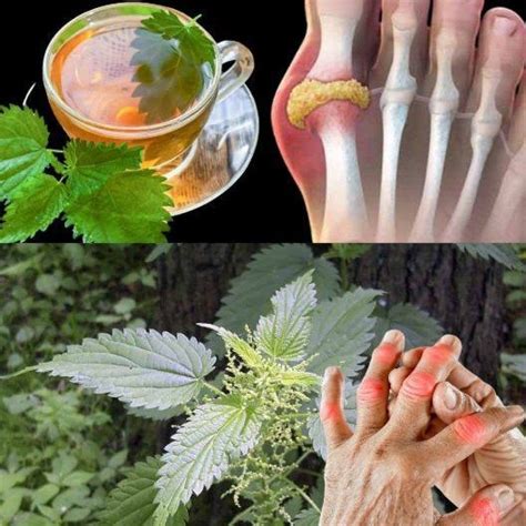 Харесва 8 прости начина за естествено намаляване на излишната пикочна киселина статията в