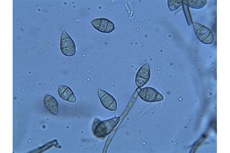 Typical Pyricularia Oryzae