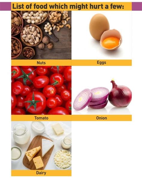 Migraine Protocol Preeti Shah