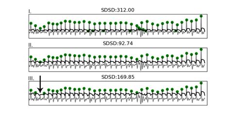 Algorithm Functioning — Python Heart Rate Analysis Toolkit 125
