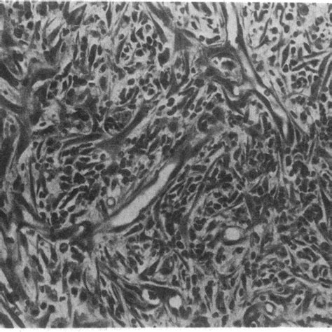 Morphological Features Of Sponges After Sustained Release Of Egf A Download Scientific