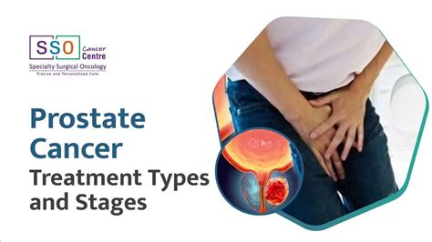Prostate Cancer Treatment Options Different Types Of Prostate Cancer