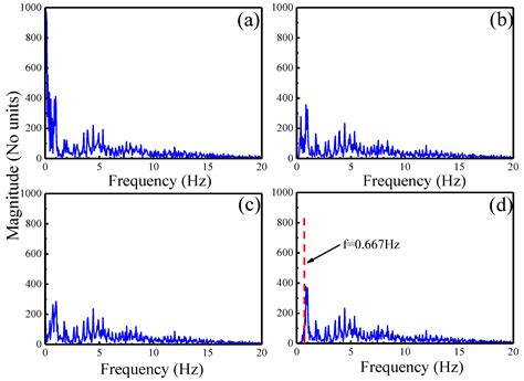 Adaptive Motion Artifact Reduction Based On Empirical Wavelet Transform And Wavelet Thresholding