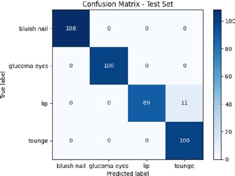 Figure 6 11 From Vitamin Deficiency Detection Using Neural Networks