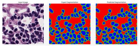 GitHub Rogerdettloff Nuclei Segmentation Tinkering With A Deep Learning Approach For Nuclei