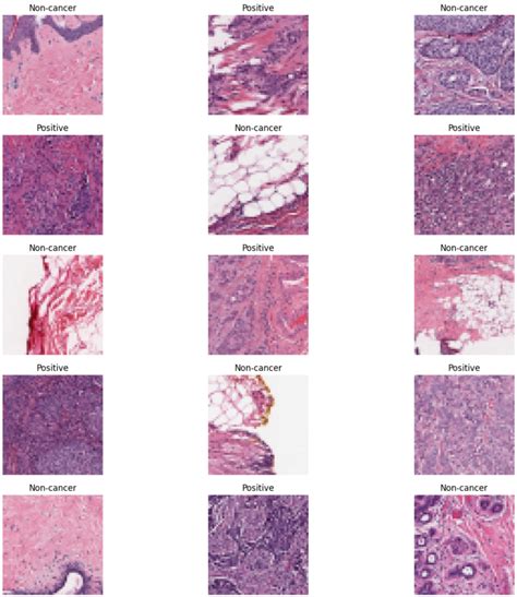 논문 리뷰 Deep Transfer Learning For Breast Cancer Classification
