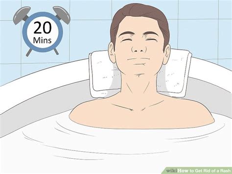 3 Ways To Get Rid Of A Rash WikiHow 3 Ways To Get Rid Of A Rash WikiHow