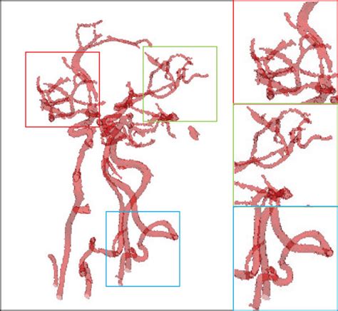 Medical Image Segmentation Results Tested In The Dataset Of The