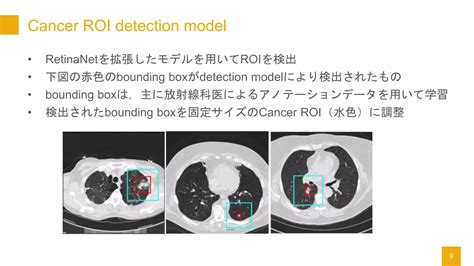 End To End Lung Cancer Screening With Three Dimensional Deep Learning