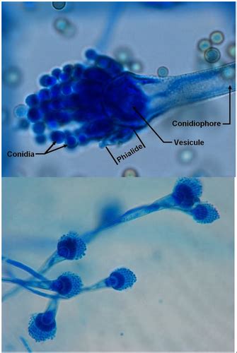 Aspergillus Slide Labeled