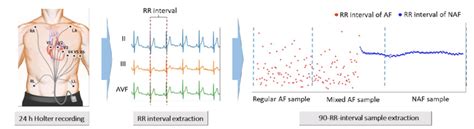 Preprocessing Procedure Af Atrial Fibrillation Naf Non Af Both Download Scientific Diagram