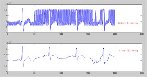 ADS1298 ADS1298 Usage Problems Data Converters Forum Data Converters TI E2E Support Forums