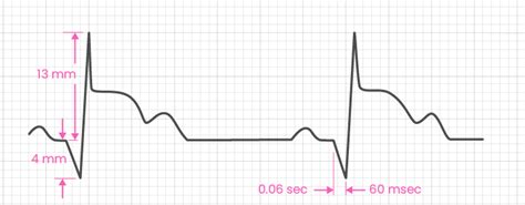 Q Wave Skillstat