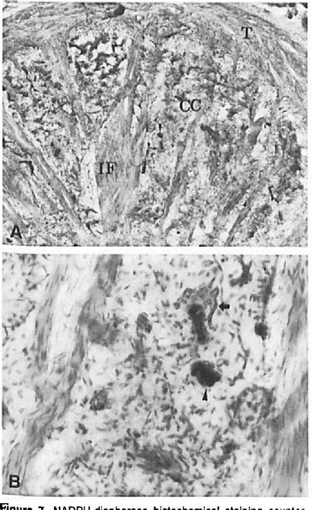 Figure 1 From Nitric Oxide Cyclic Gmp Signaling Pathway In The