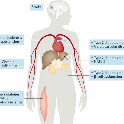 Mitochondrial Dysfunction In Age Related Metabolic Diseases