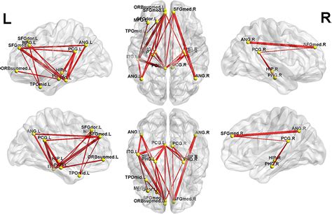 Frontiers Functional Network Based Statistics Reveal Abnormal Resting