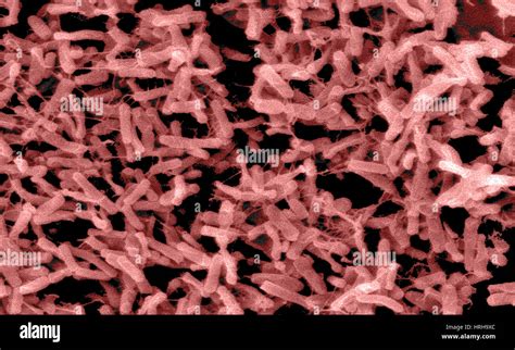 Electron Micrograph Clostridium Difficile Bacteria Hi Res Stock