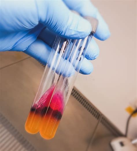Salmonella Detection Method By Using Triple Sugar Iron Tsi Agar In