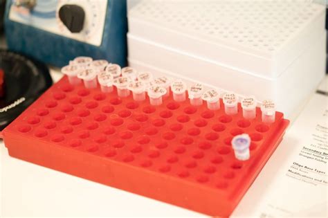 Detecting Rna Modifications Gurdon Institute