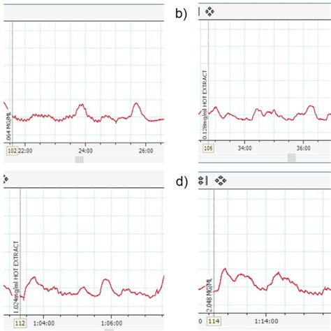 Contractions Induced By 5 Iuml Of Oxytocin Download Scientific Diagram