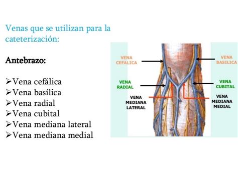 Cateterizacion