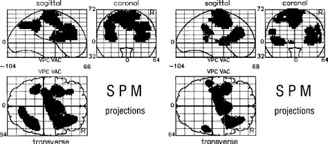 Figure 1 From Self Initiated Versus Externally Triggered Movements Ii