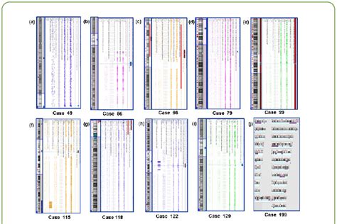pathogenic genomic imbalances cytoscan 750k microarray profile a to