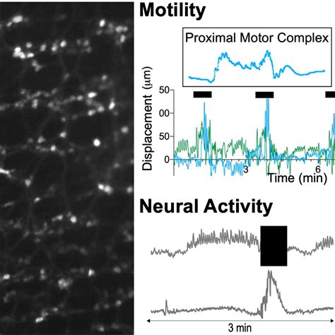 Pennsieve Myenteric Neuron Activity During Spontaneous Motor Complexes