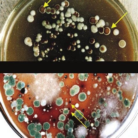Pdf Environmental Prevalence Of Cryptococcus Neoformans And