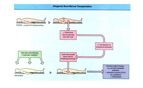 Hematopoietic Stem Cell Transplantation Flashcards Quizlet