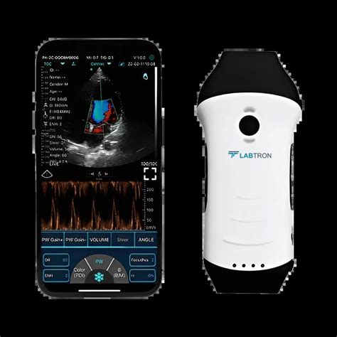 Portable Ultrasound Scanner Lpus A11│wireless Ultrasound Scanner