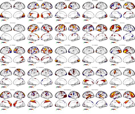 Figure 10 From Accurate Estimation Of Functional Brain Connectivity Via
