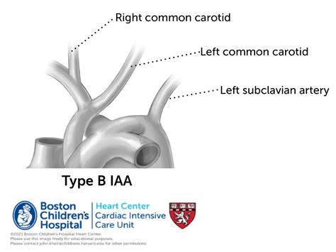 Vsd Iaa Online Supplement