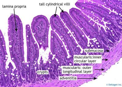 Small Intestine Slide