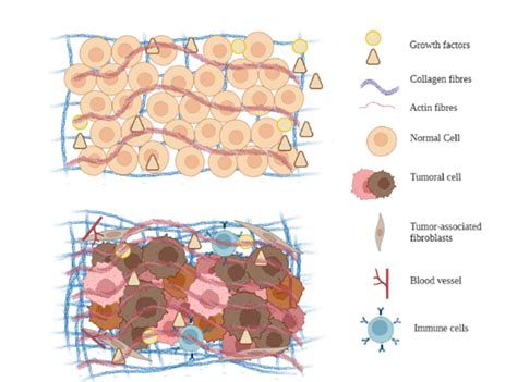 Comparison Between The Architecture Of Healthy Cell Tissue And Tumor Download Scientific