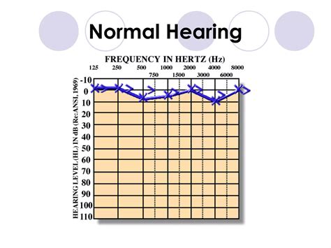 Reading An Audiogram Ppt