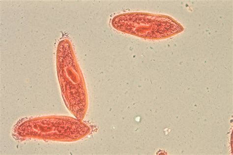 Biol 101 Lab Extra Credit Flashcards Quizlet