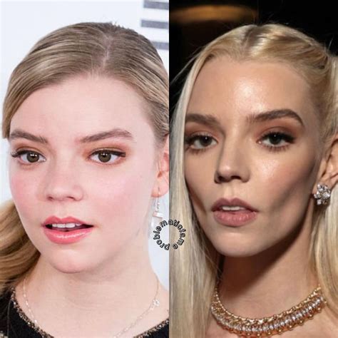 Así Se Veía Anya Taylor Joy Antes De Sus Cirugías Estéticas Parecía