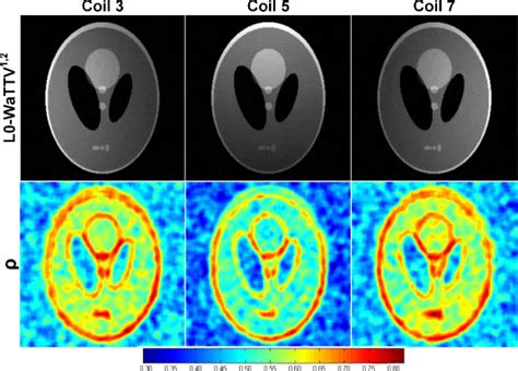 Top Three Reconstructed Coil Images Using L0 Wattv12 Under Cartesian