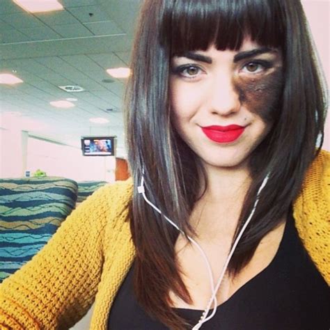 母斑を治療しなかった女性。「これは私の個性。感謝してるわ」 Tabi Labo