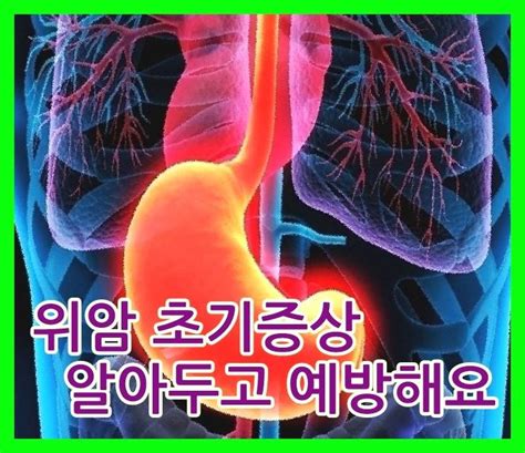 위암초기증상 미리알아개선해요