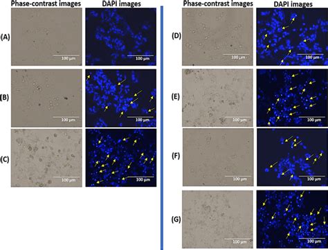 Assessment Of Dna Damage By Dapi Staining A Control Cells Bc