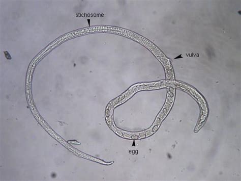 Parasite Quiz Flashcards Quizlet
